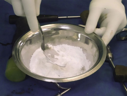 Consumables & Disposable – Vandana Medical, Durg | Medical Equipment ...